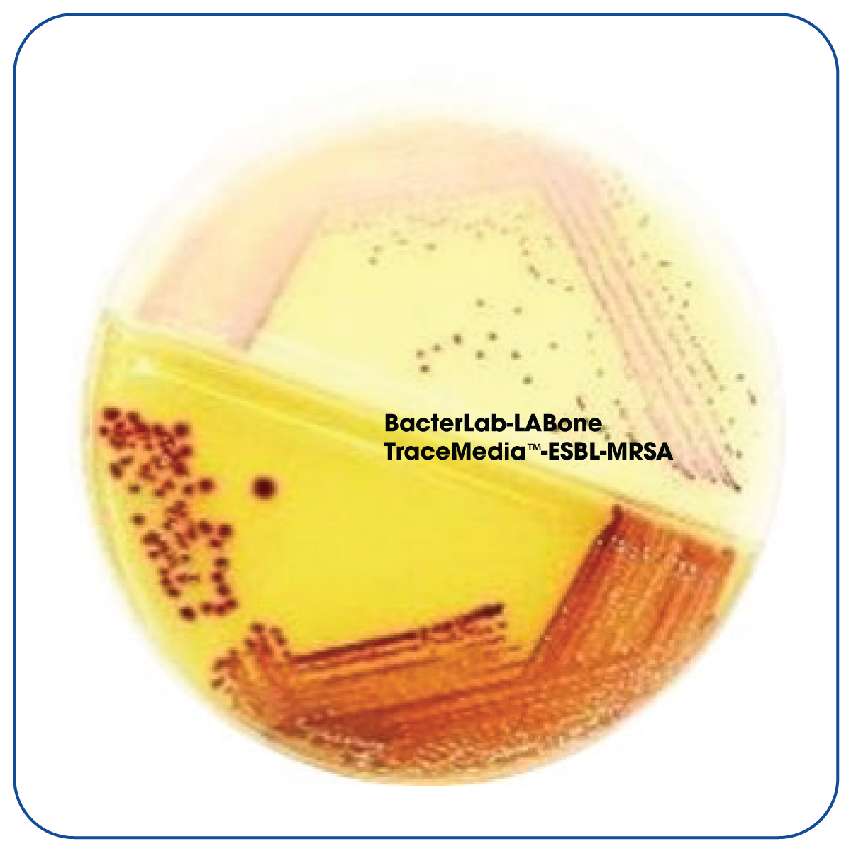 TraceMedia™ ESBL/ MRSA - Bacterlab