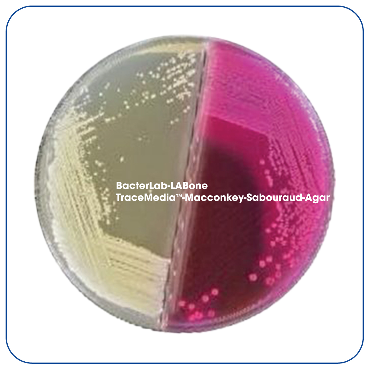 TraceMedia™ MacConkey Agar/ Sabouraud Agar - Bacterlab