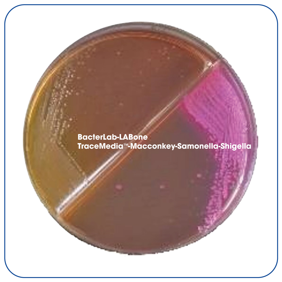 TraceMedia™ MacConkey Agar/ Sabouraud Agar - Bacterlab