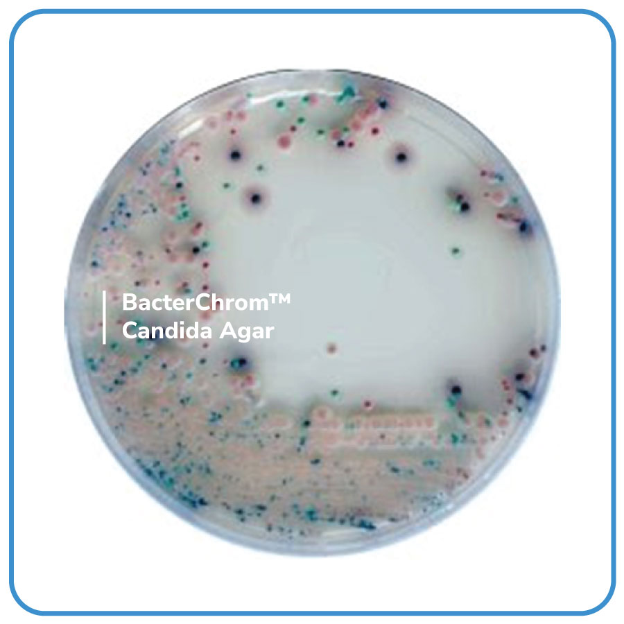 BacterChrom™ Candida Agar - Bacterlab