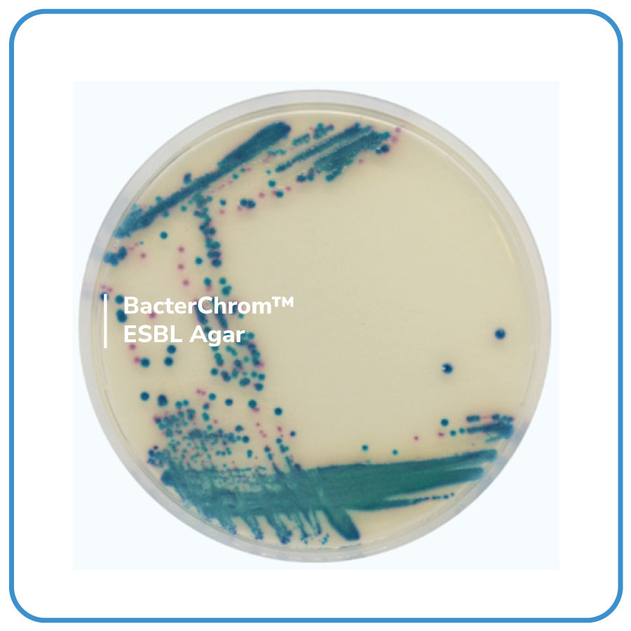 BacterChrom™ ESBL Agar - Bacterlab