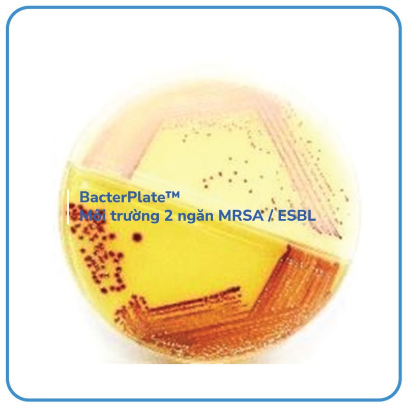 BacterPlate™ Môi trường 2 ngăn TCBS/ SS - LABone Scientific Co.Ltd.,