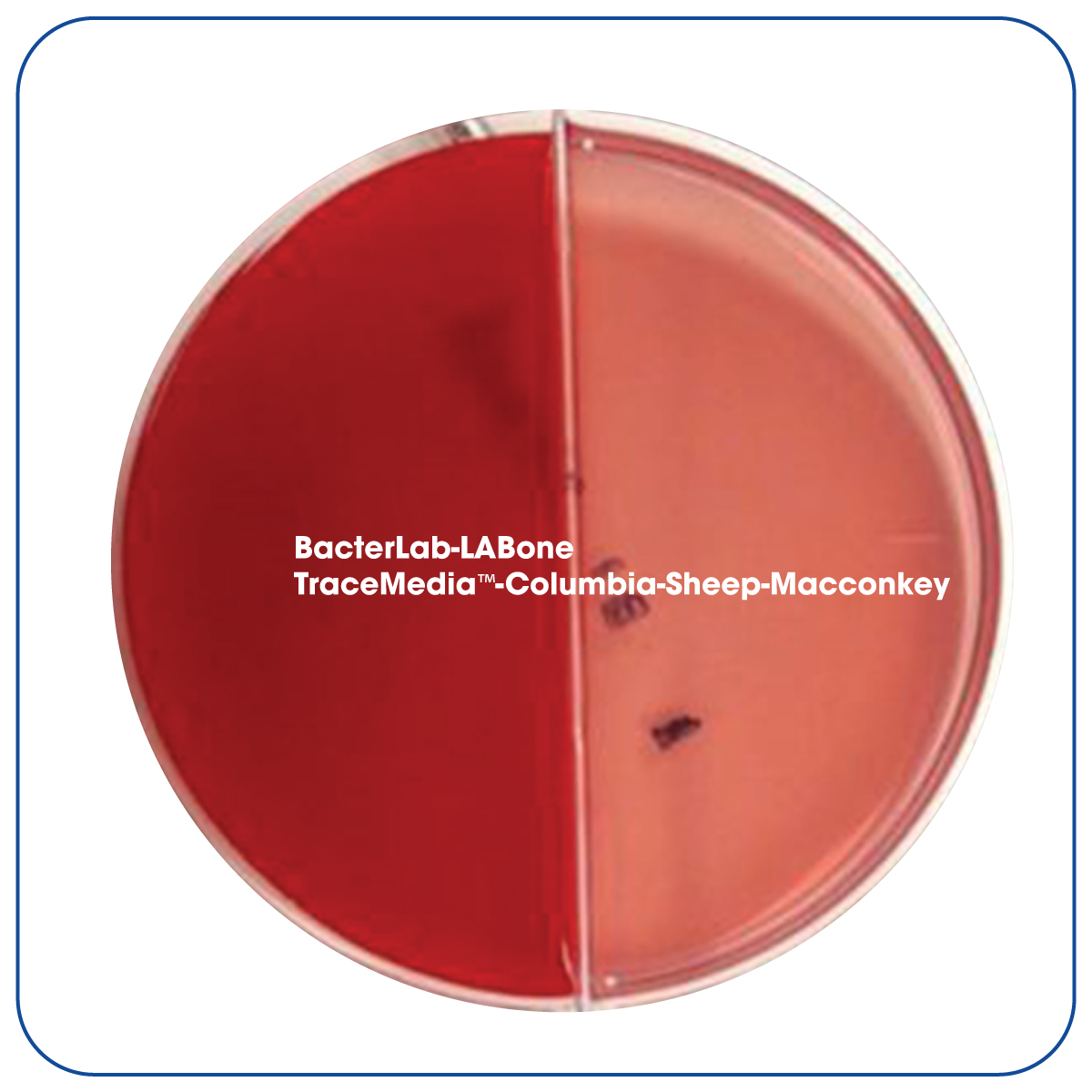 TraceMedia™ MacConkey Agar/ Samonella Shigella Agar - LABone Scientific ...