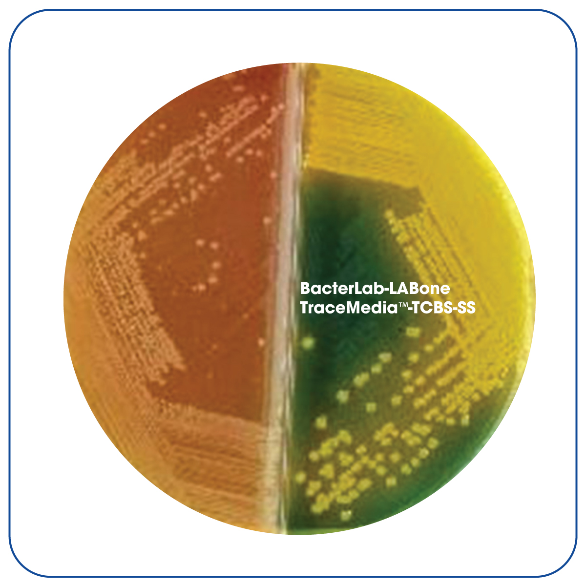 TraceMedia™ MacConkey Agar/ Sabouraud Agar - LABone Scientific Co.Ltd.,