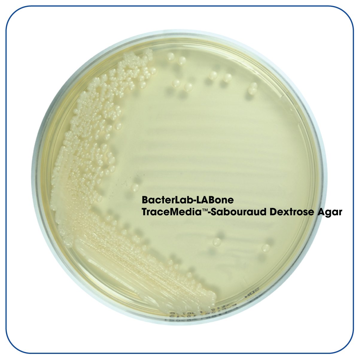 Can Bacteria Grow On Sabouraud Dextrose Agar at Russell Hixson blog