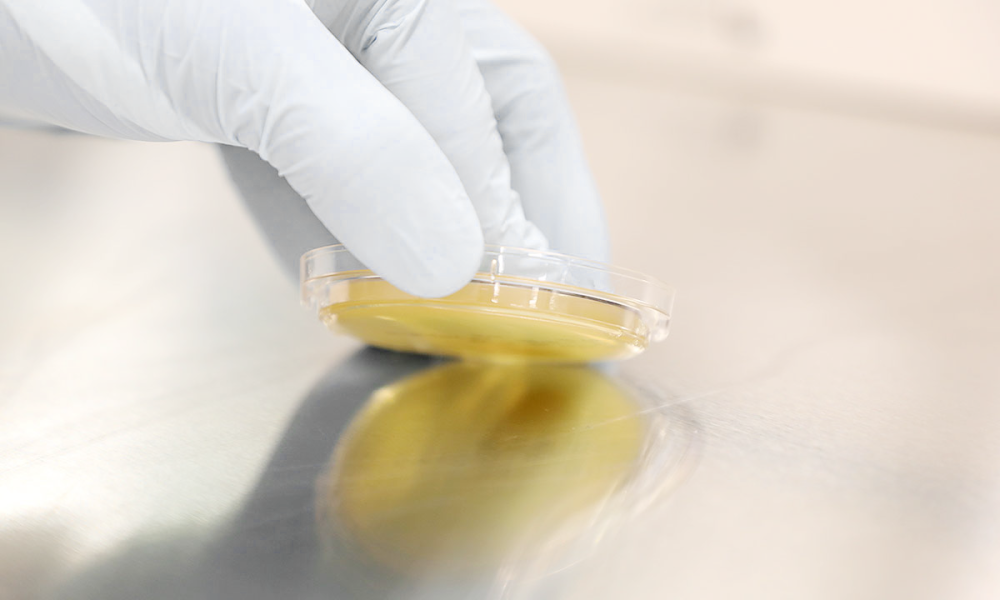 MICROBIOLOGICAL SAMPLE COLLECTION - LABone Scientific Co.Ltd.,