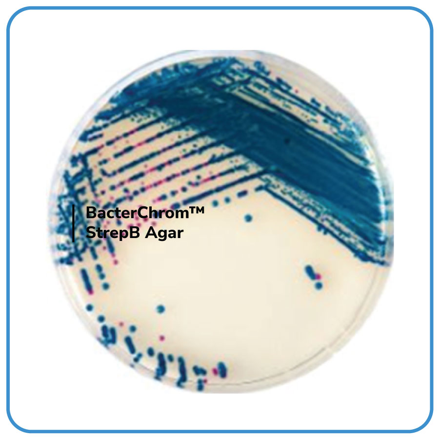 BacterChrom™ StrepB Agar - LABone Scientific Co.Ltd.,