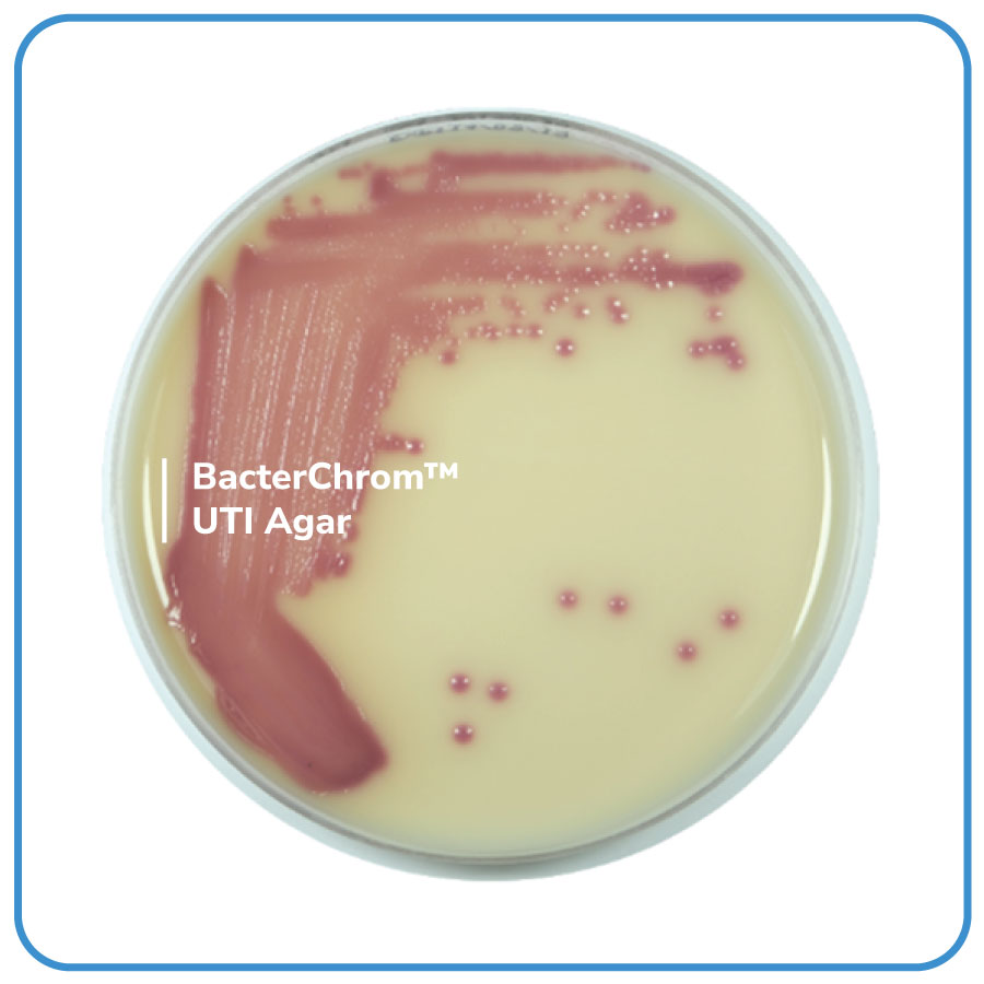 BacterChrom™ UTI Agar - LABone Scientific Co.Ltd.,